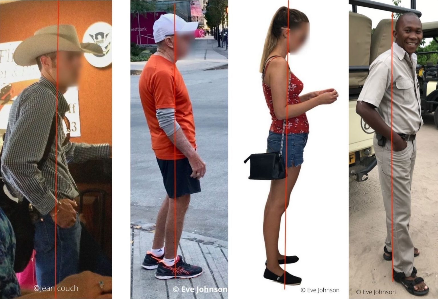 Hyper-kyphosis: are we ignoring the real cause? - Spinefulness